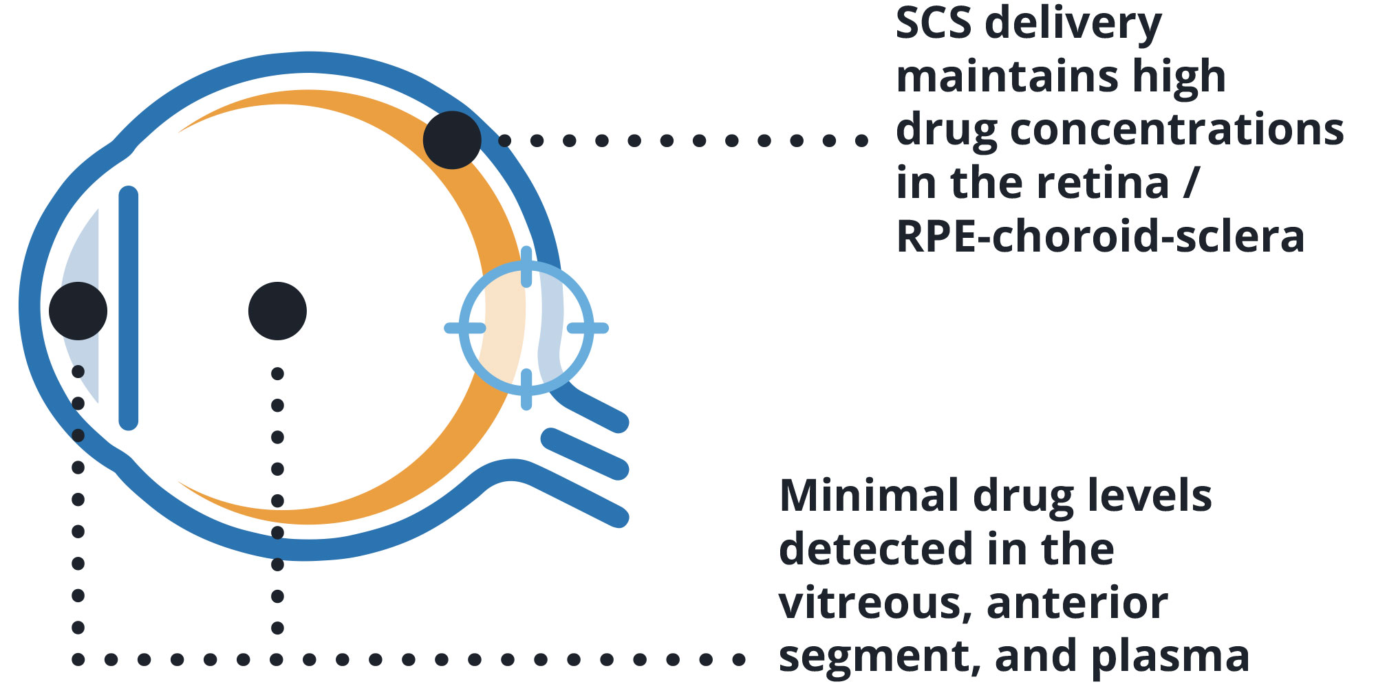 CLS-AX – Clearside Biomedical
